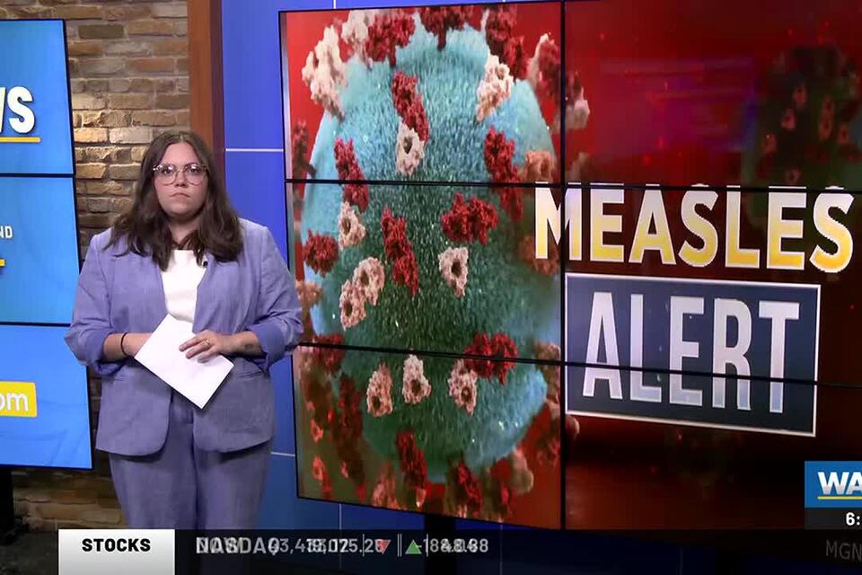 How health providers say we cant prevent the spread of the measles in ...