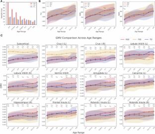 Age-varying distinct neuroanatomy in young children with autism ...