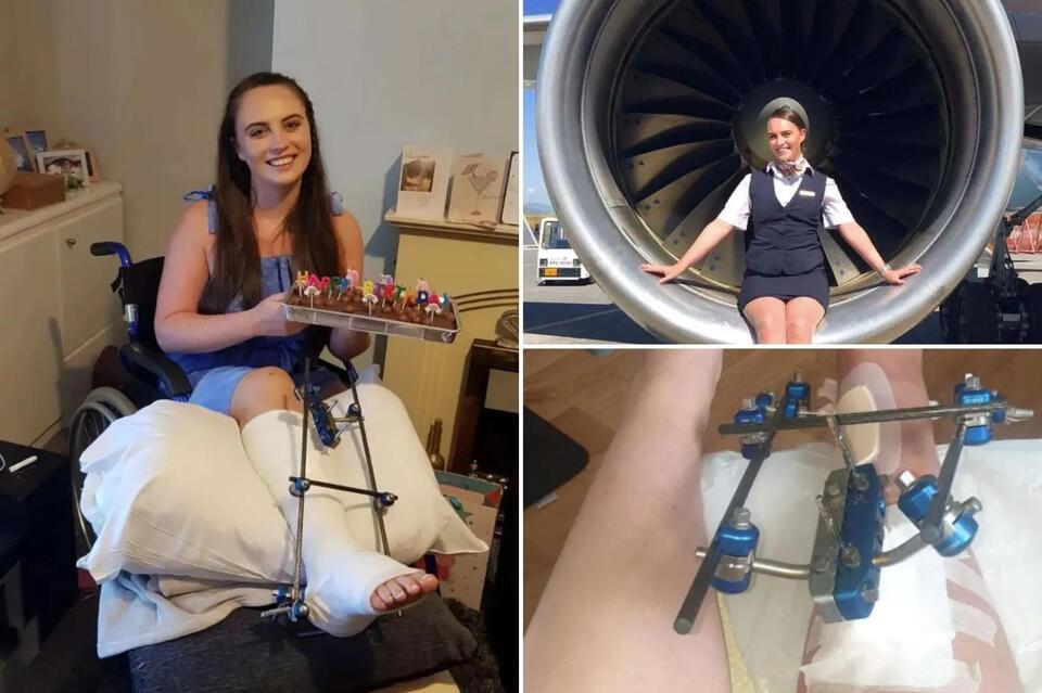 I’m a flight attendant — I broke my leg in seven places because of ...