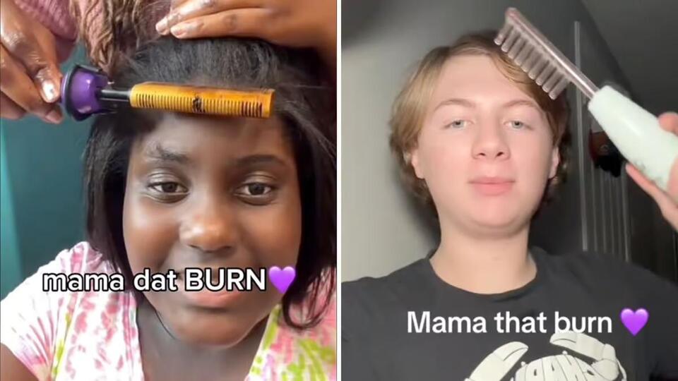 What’s the viral ‘Mama dat burn’ meme on TikTok? - NewsBreak