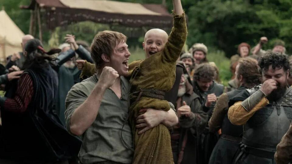 Why Is Egg (Aegon V) Bald in A Knight of the Seven Kingdoms? - NewsBreak