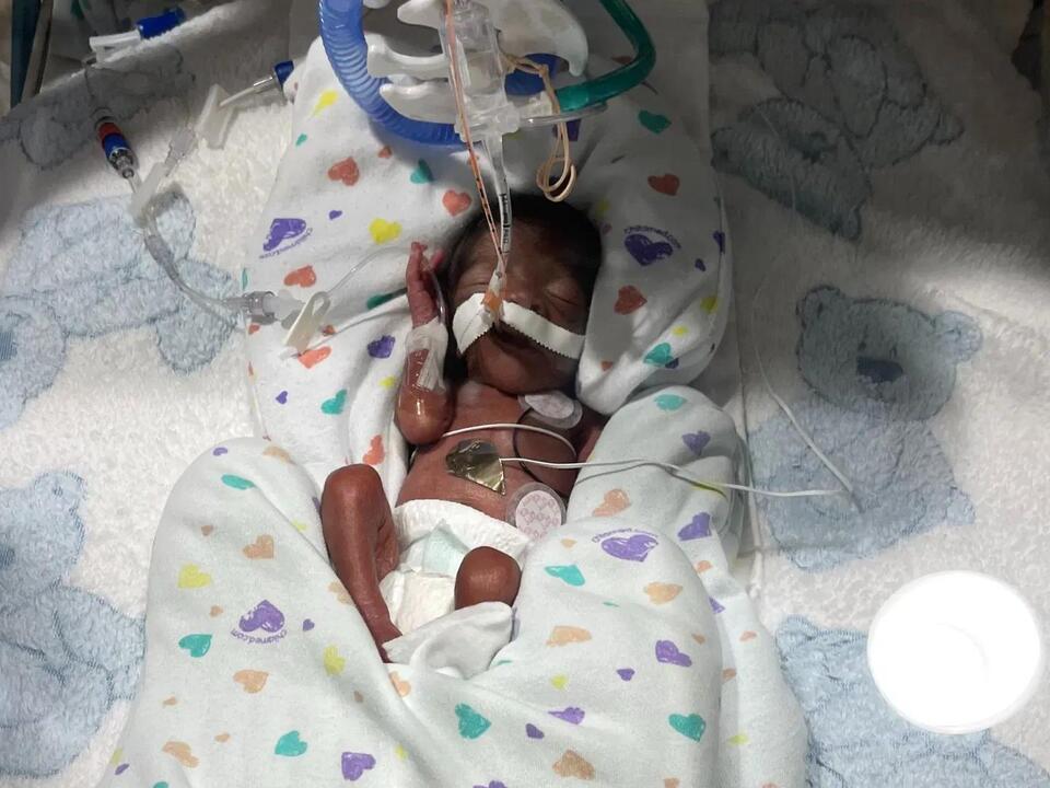 Born at 1 lb. 4 oz., baby Jerry now ready to 'March for Babies' in ...