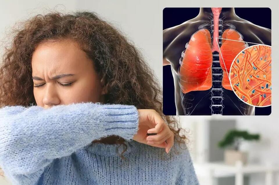 Highly Contagious 100-Day Cough Surging in Minnesota - NewsBreak