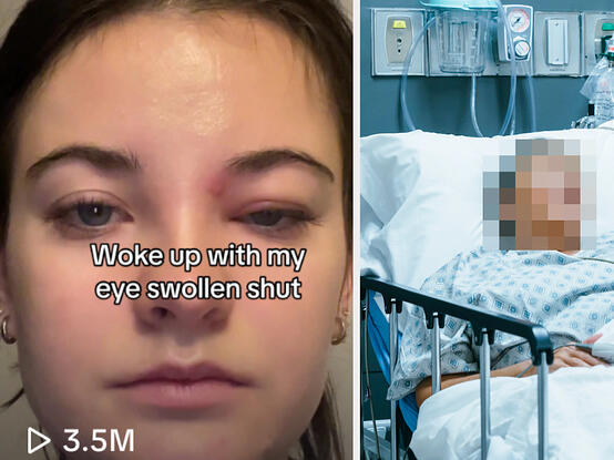 Brooke Hyland From “Dance Moms” Popped A Pimple On Her Face’s “Triangle ...