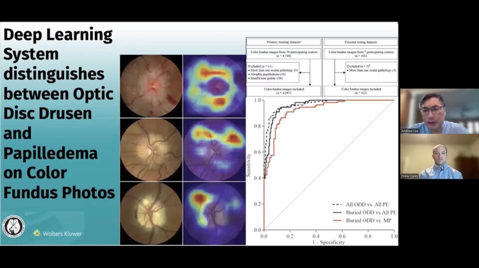 VLOG: NeuroOp Guru: Can AI distinguish between papilledema and optic ...