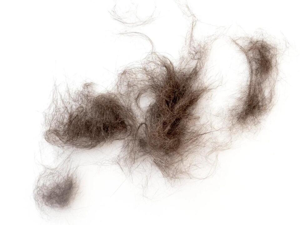 Doctors Pulled a 2-Pound Hairball From a Woman’s Stomach