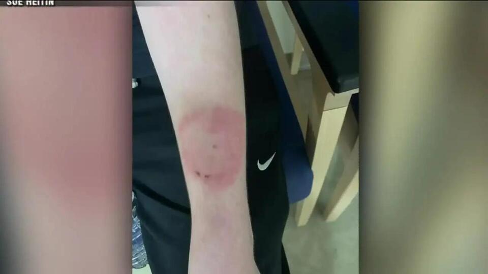 ‘Inhumane’: 15-year-old bit by man after suspect allegedly publicly ...