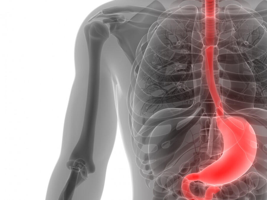 How Endoscopic Therapy Cured Vic Padilla’s Precancerous Barrett’s Esophagus