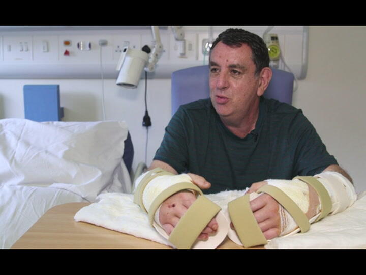 Double hand transplant patient saved from organ rejection after ‘world ...