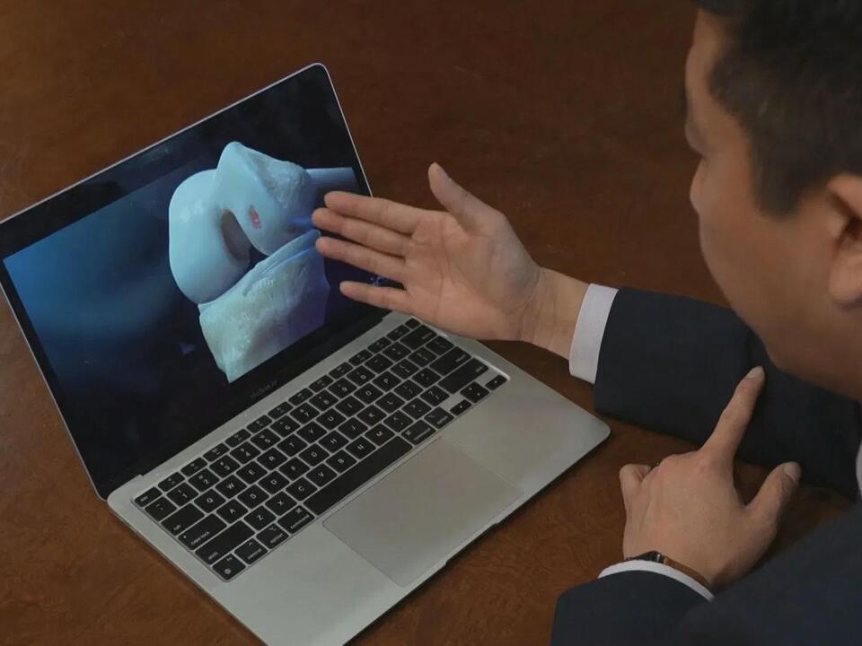 Breakthrough treatment gives new hope for complex knee surgeries