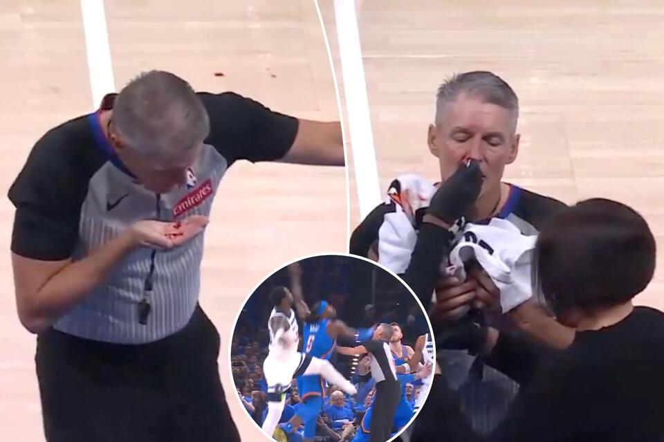 NBA ref Scott Foster bloodied after getting smacked in face in scary ...