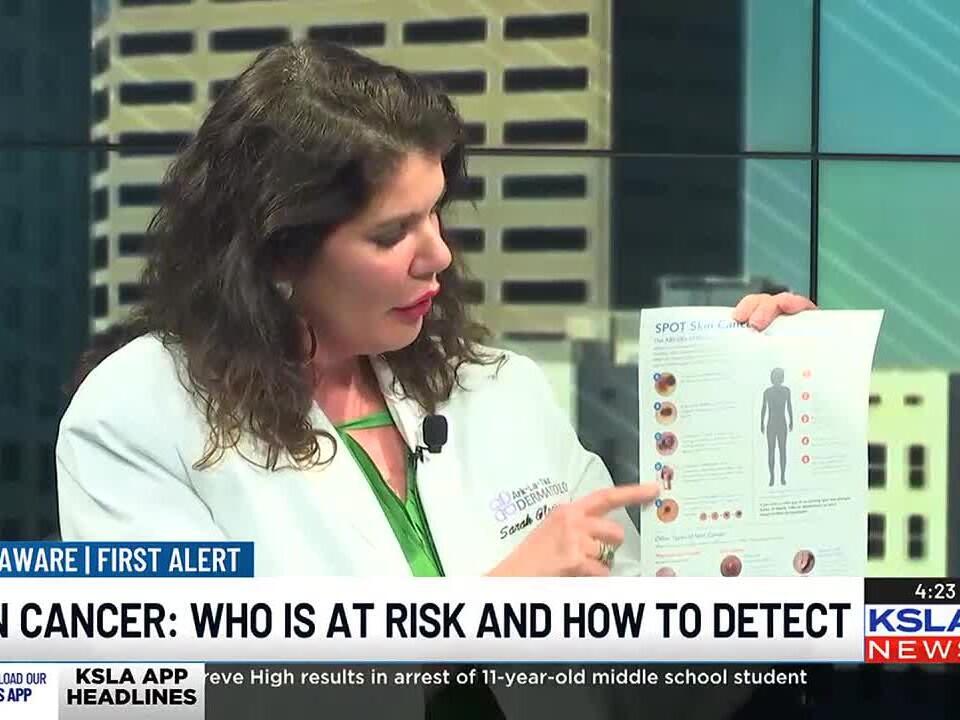 Dermatologist explains how to detect melanoma, the deadliest form of ...