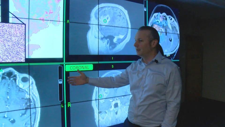 IU prof shares how AI is being used to recognize cancer in brain scans ...