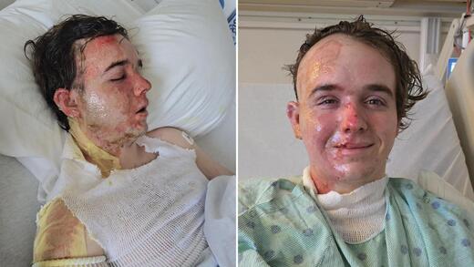 'Why would he do this to me?': McDonald's worker hurls hot oil on 20 ...
