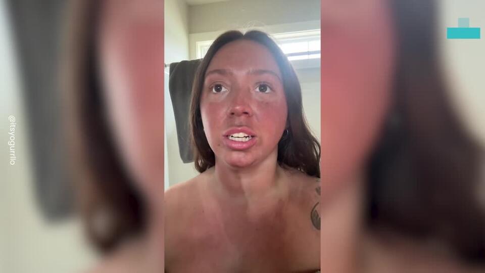 Spray Tan Goes Wrong Before Honeymoon - NewsBreak