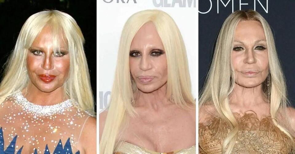 Donatella Versace's Wild Transformation Revealed: See How Much the ...