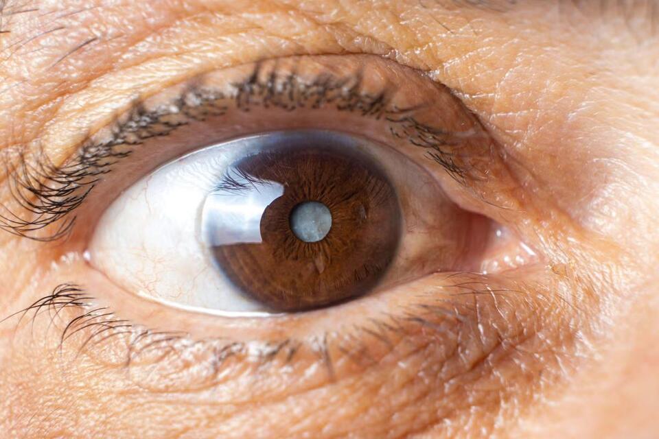 Study finds double cataract surgery is better for patients - NewsBreak