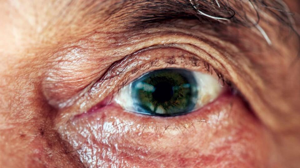FDA approves Vizz eye drops to improve near vision in adults - NewsBreak