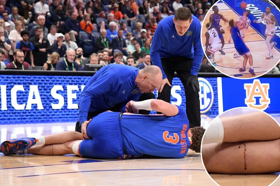 Florida’s Micah Handlogten suffers gruesome leg injury during SEC ...