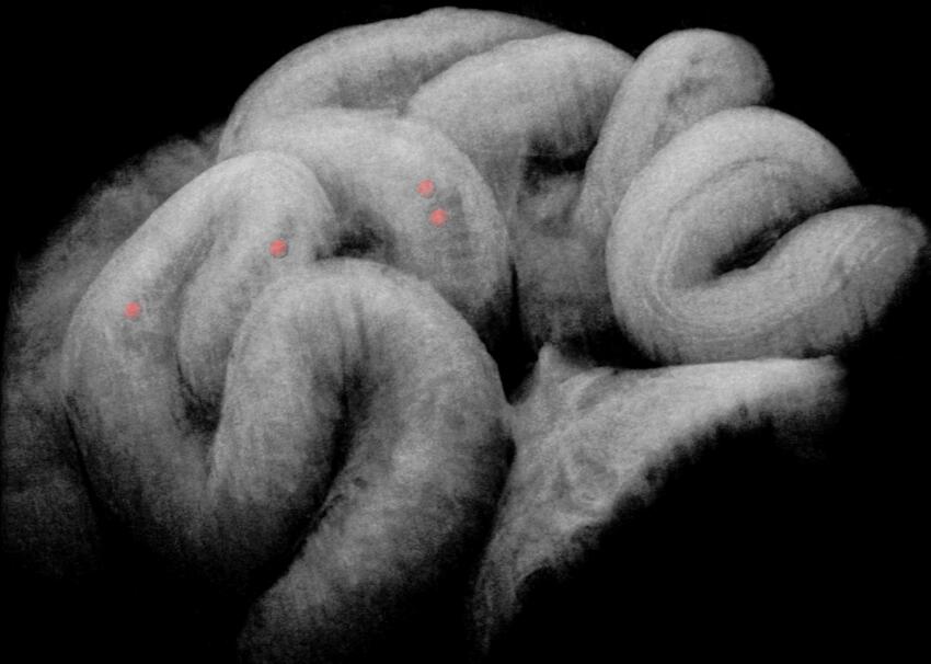 A literal window into how the fallopian tube transports embryos - NewsBreak
