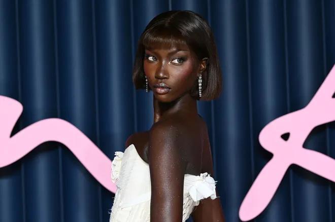 ‘Forever Grateful’ — Anok Yai Opens Up About Undergoing Surgery For ...