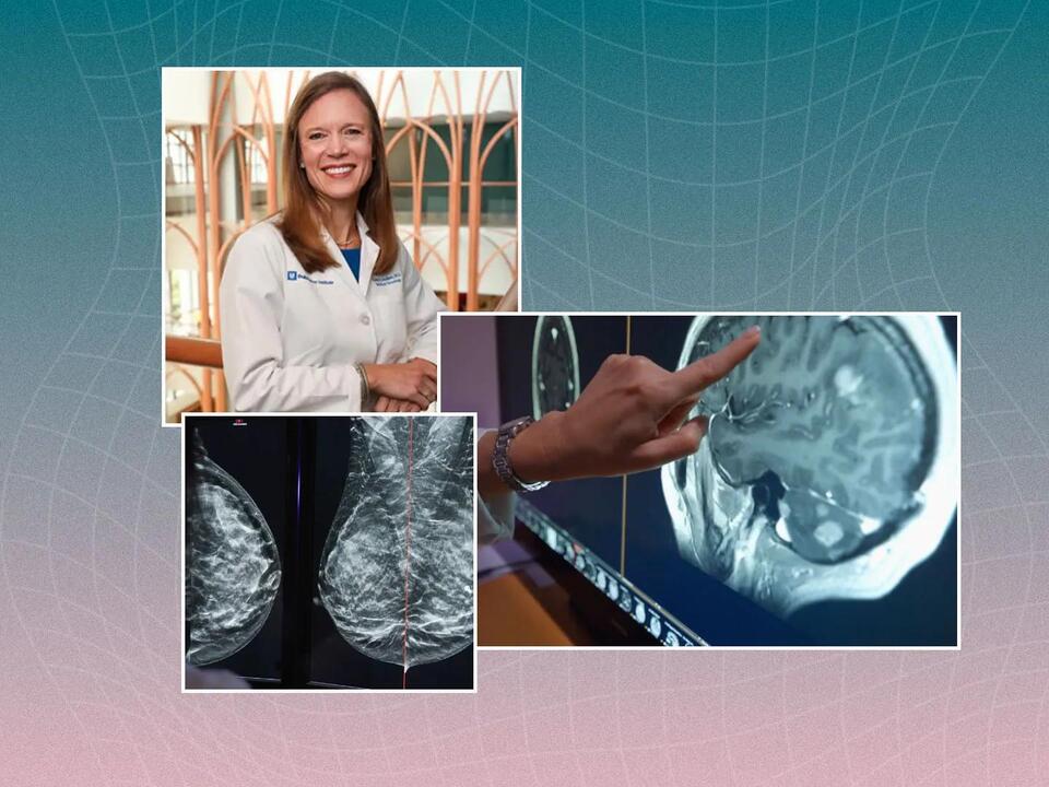 3 Things We Learned About Breast Cancer From PBS’ New Documentary ...