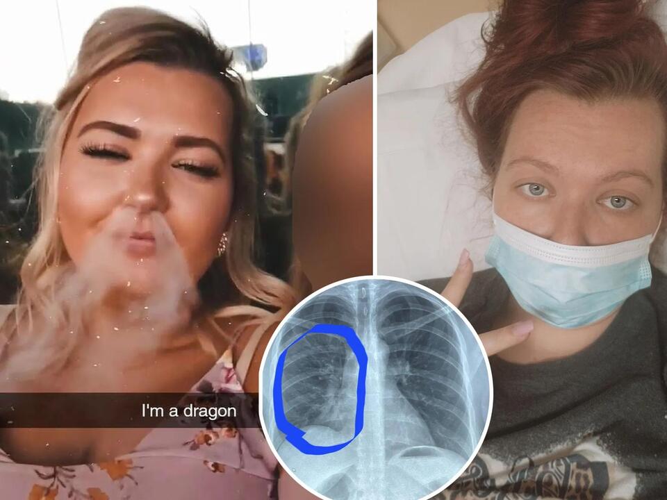I was addicted to vaping — until docs said it was ‘frying my lungs like ...