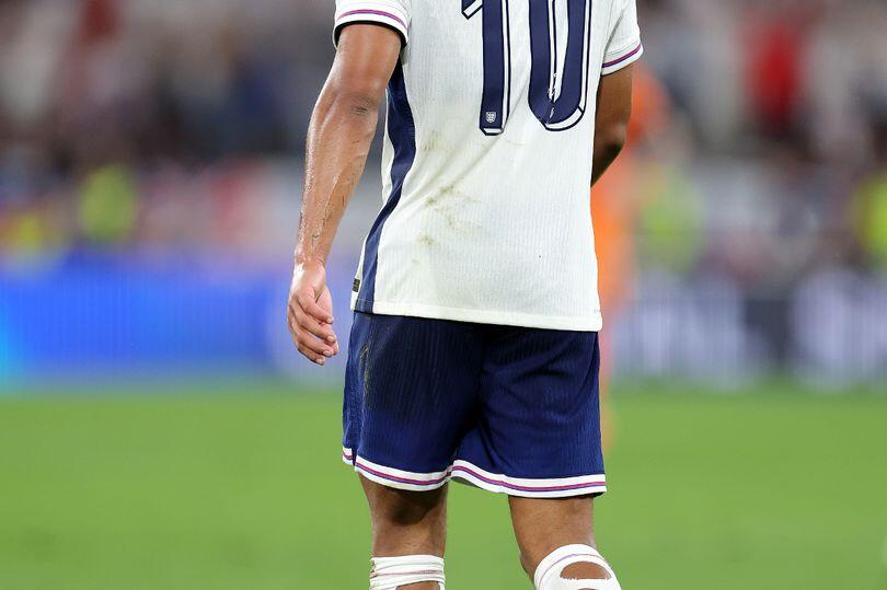 Why Jude Bellingham and other England players cut holes in socks ...