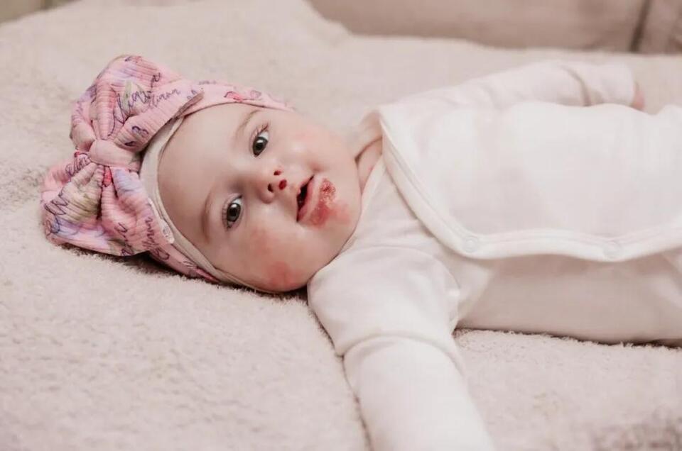 Brewer baby who inspired millions on TikTok dies of rare skin disease ...