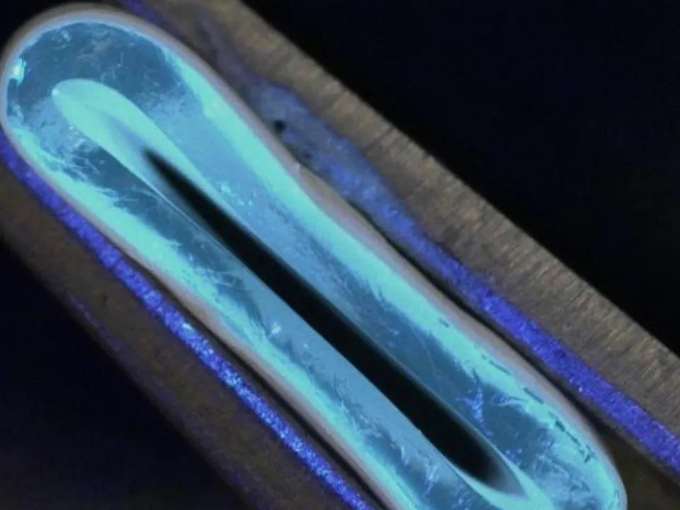 3D-Printed Blood Vessels Could Improve Outcomes for Heart Bypass Patients