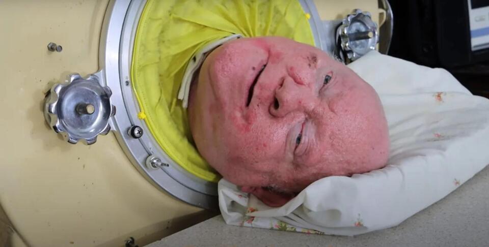 Polio Paul dies aged 78 – ‘The Man in the The Iron Lung’ who spent 70 ...