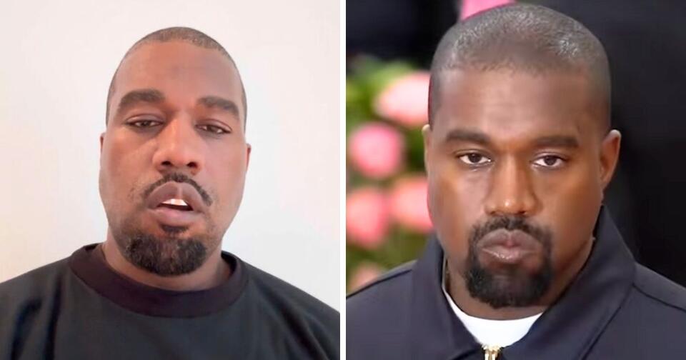 Kanye West Blames Erratic Behavior on ‘Brain Injury,’ Says: “I Am Not a ...