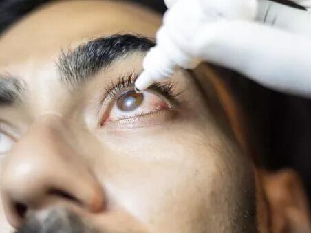 Recalled Eye Drops Sold In Michigan Could Cause 'Infection And Harm'