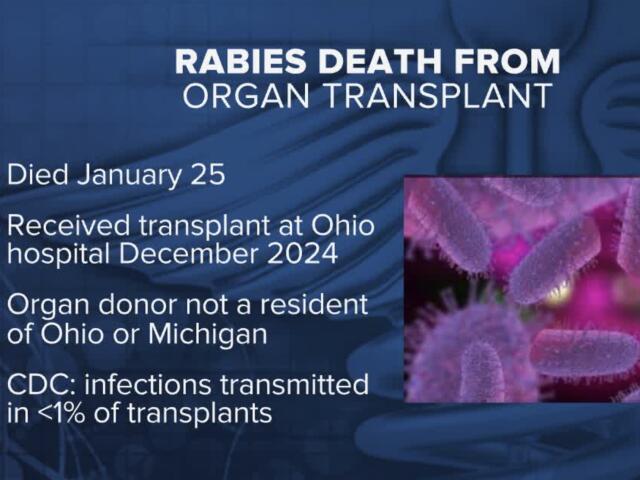 Michigan resident dies of rabies after receiving organ transplant in ...