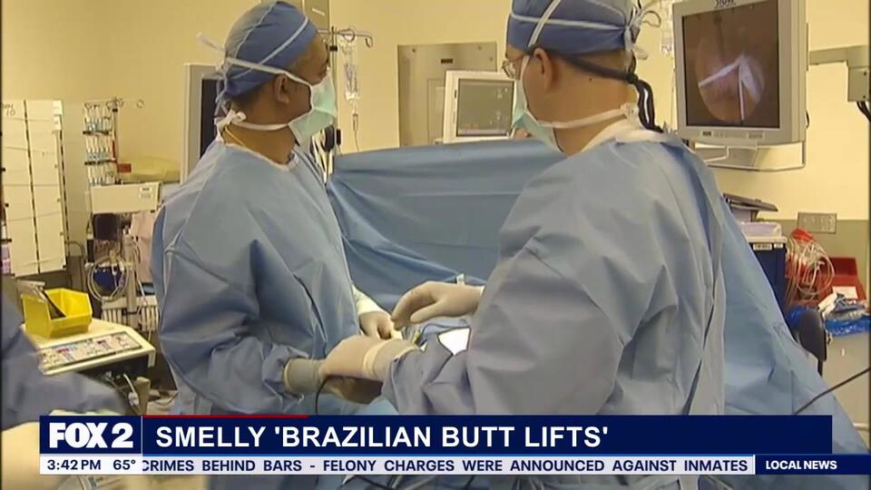 What is the 'BBL Smell' and is it real? - NewsBreak