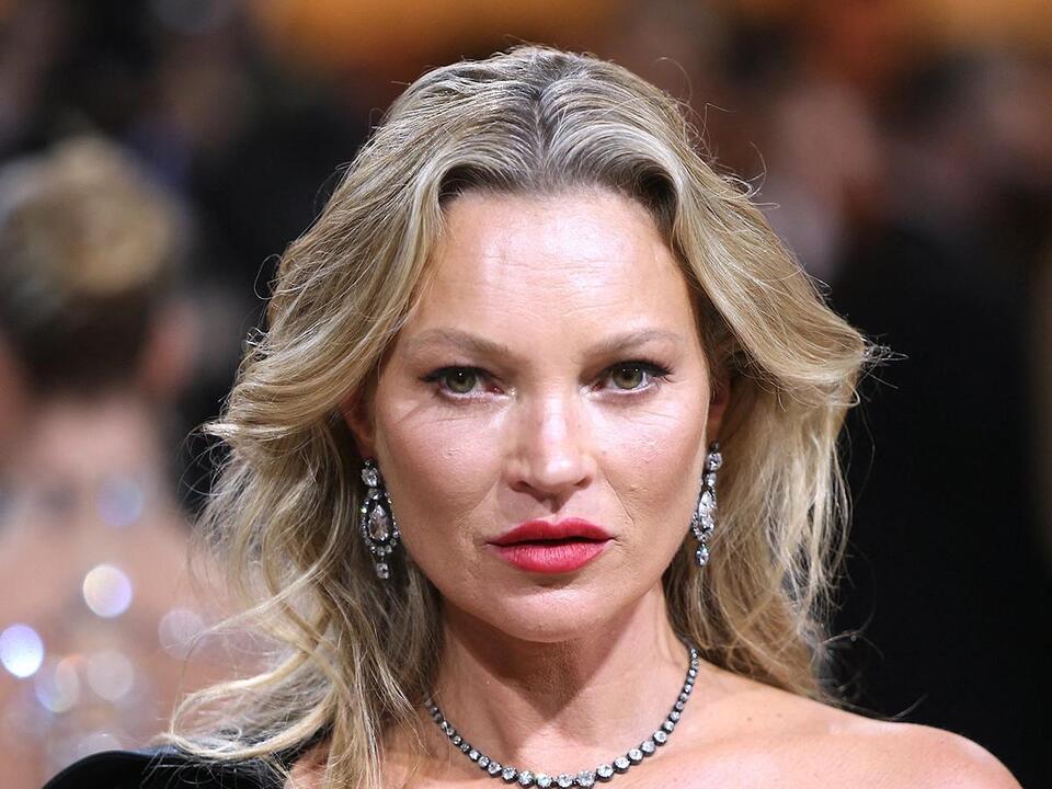 Fans Think Kate Moss Got An 'Under The Radar' Facelift After Seeing ...