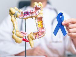 FDA Breakthrough Therapy Designation Granted For Promising Rectal ...