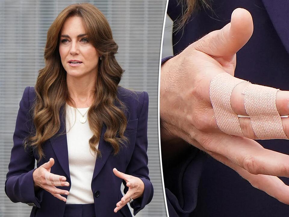 Kate Middleton turns up for prison visit with her fingers bandaged ...