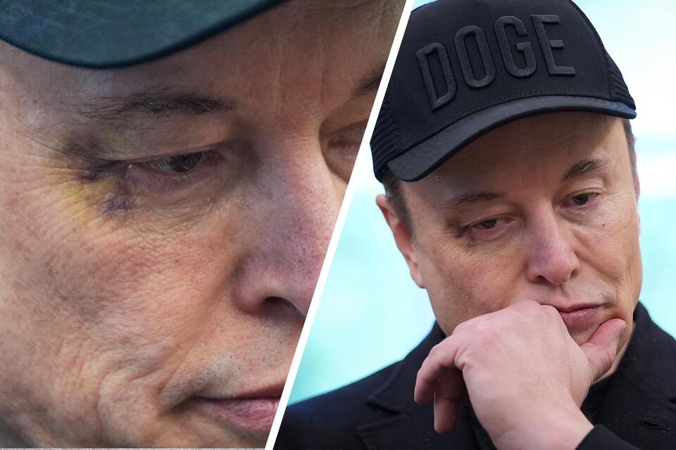 Elon Musk sports BLACK EYE, reveals who left him with shiner - NewsBreak