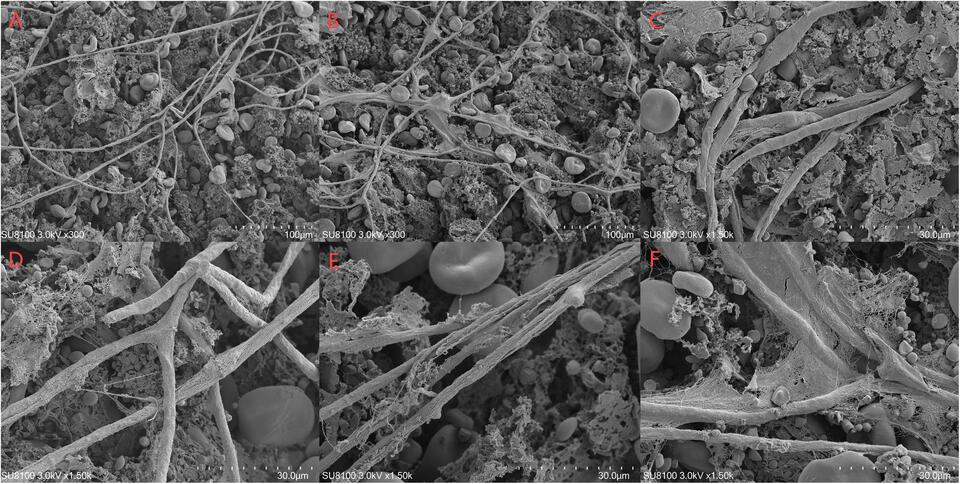 Screening for resistance to Pyrenophora graminea in hulless barley ...