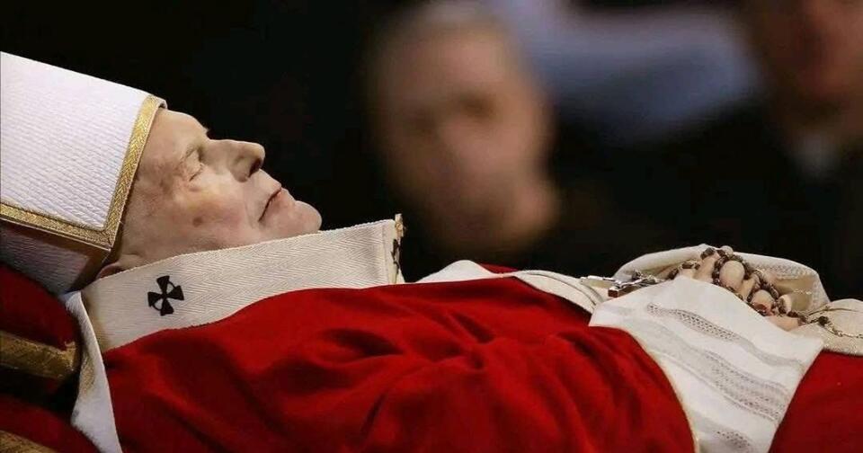 Bruise on Pope Francis’s Face Sparks Questions—Is It Normal or ...