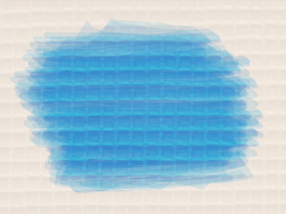 'Blue Waffle Disease' Sounds Pretty Terrifying—but What Is It?