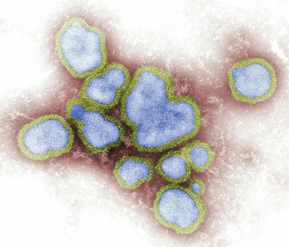 Urgent CDC data, analyses on influenza, bird flu go missing as ...