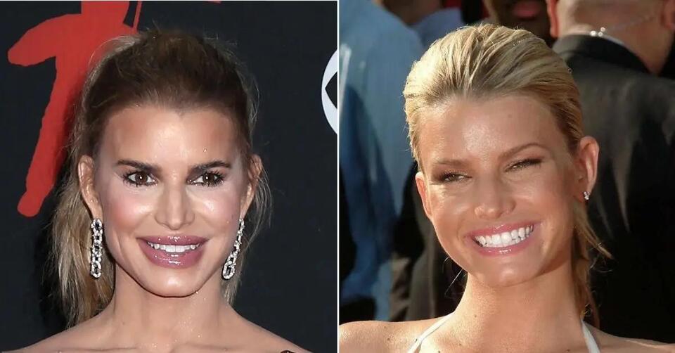 Secrets Behind Jessica Simpson's New Face: Plastic Surgeon Weigh In on ...
