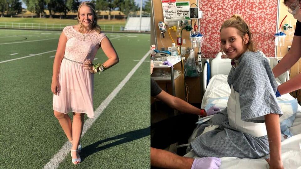 Inspiring Story of Woman Who Lost Legs in Crash Completes Pull-up ...