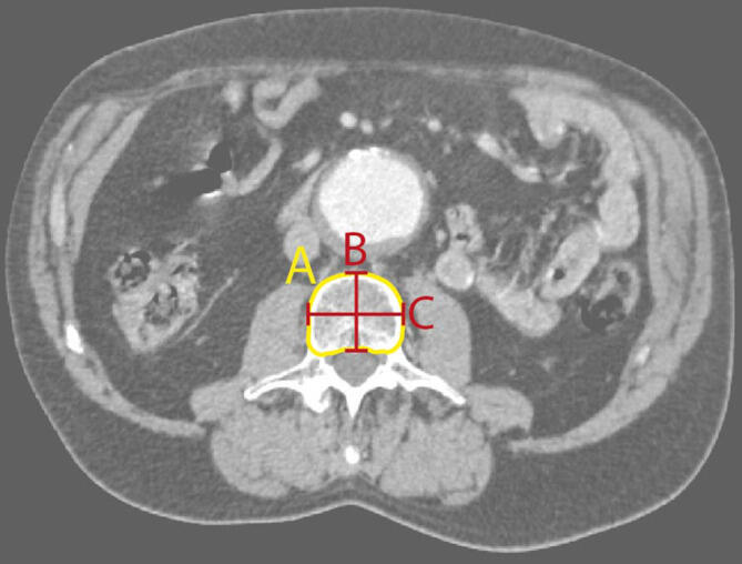 Validation of two-dimensional vertebral body parameters in estimating ...