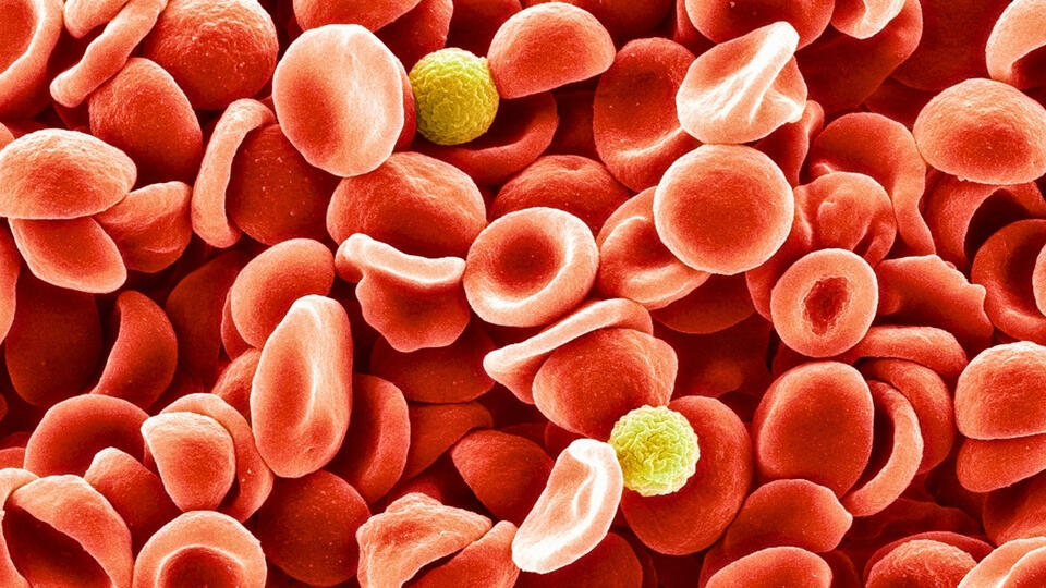 Scientists Identified a New Blood Group After a 50-Year Mystery - NewsBreak