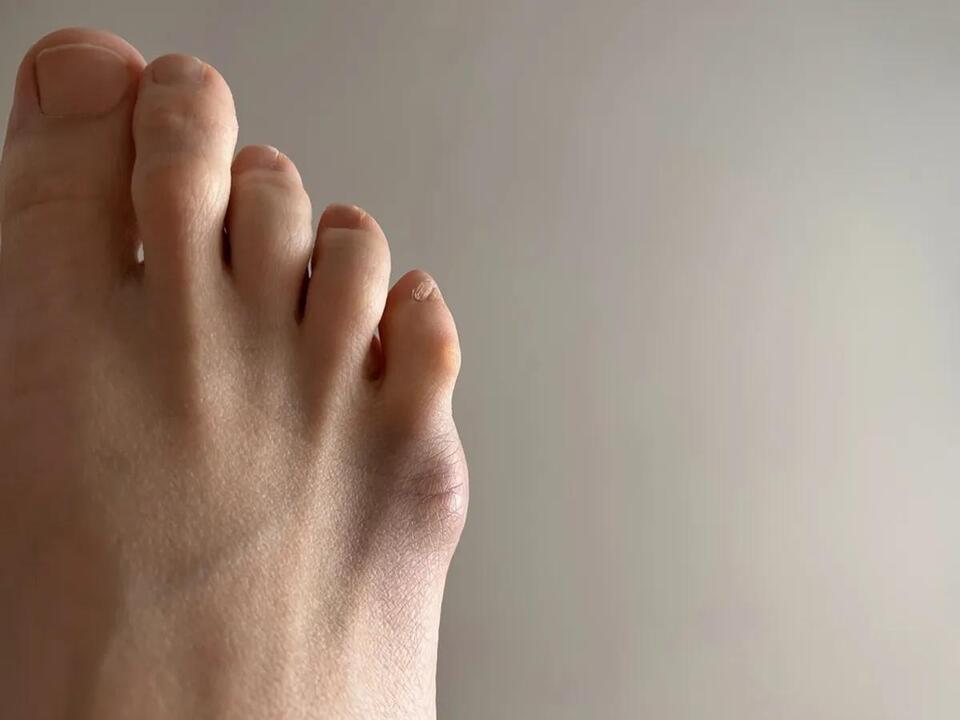 The Pinky Toe Has A Purpose And Most People Are Just Finding Out ...