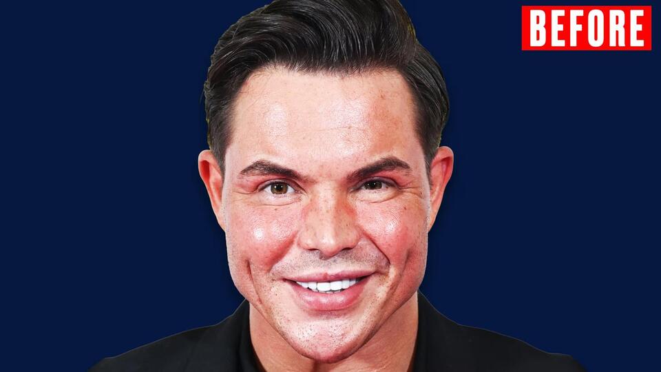 Reality Star Debuts New Face After Abusing Fillers for 10 Years - NewsBreak