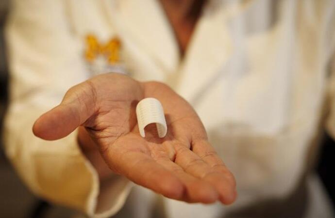 First-Of-Its-Kind Bioresorbable Implant to Help Children with Rare ...